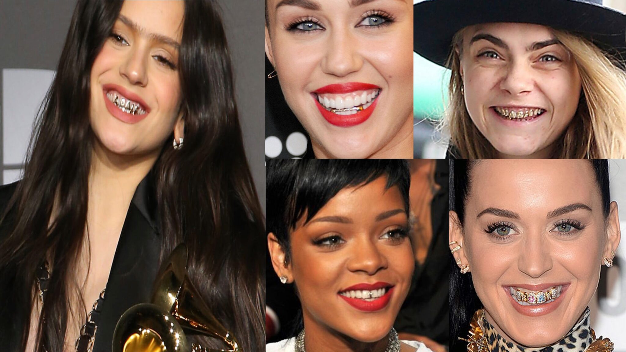 Os damos a conocer los famoso Grillz que llevan muchos famosos.